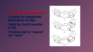 2. hip asessment | PPT