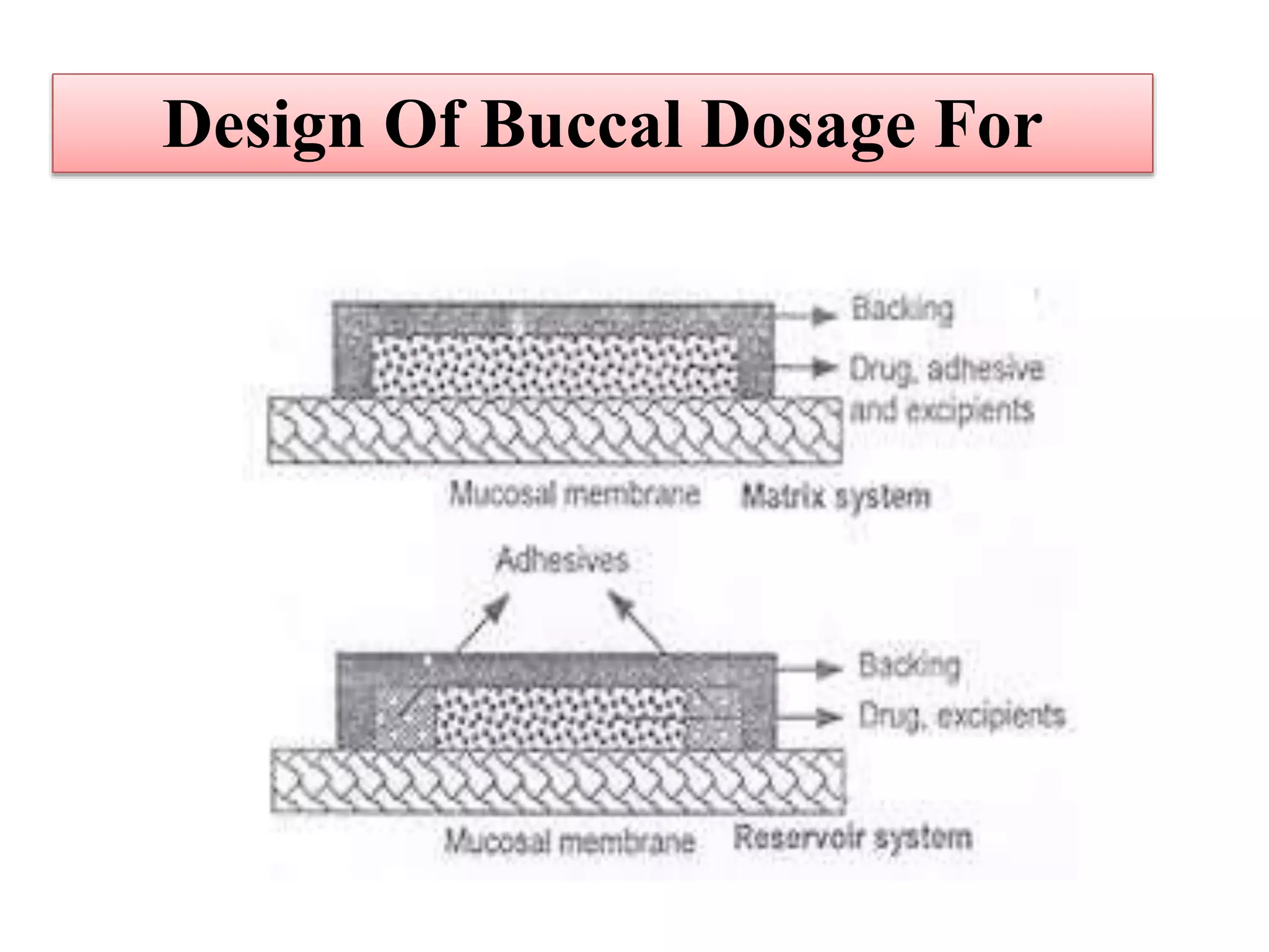 buccal drug delivery system | PPTX