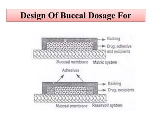 buccal drug delivery system | PPTX