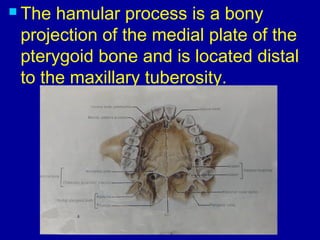 Hamular Process