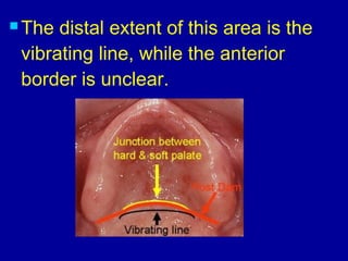 Fovea Palatini Vibrating Line