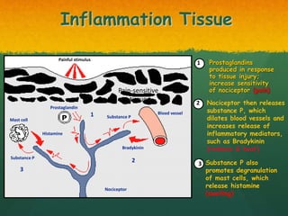 dr. Tinni - Anelgesic NSAID in WFSA Ladder | PPT