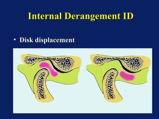 overview tmj surgery / dental courses | PPT