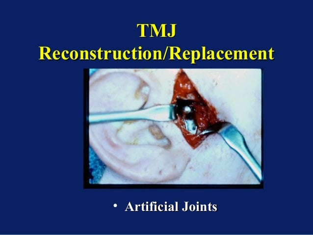 overview tmj surgery / dental courses