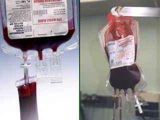 2.2 human blood | PPT