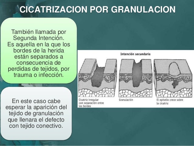 cicatrización de Heridas