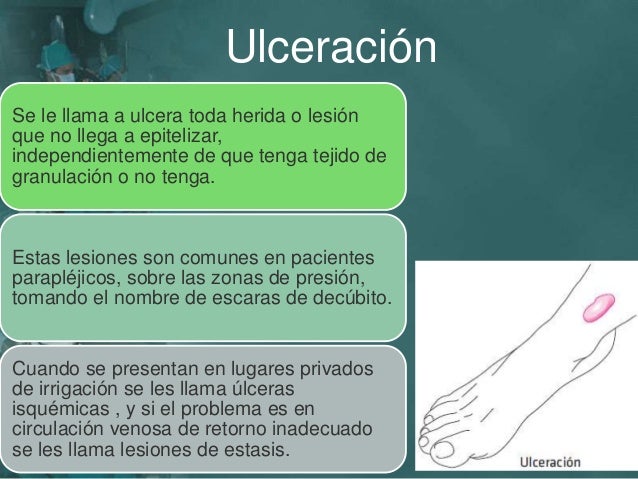 cicatrización de Heridas