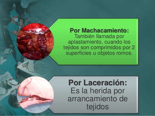 cicatrización de Heridas