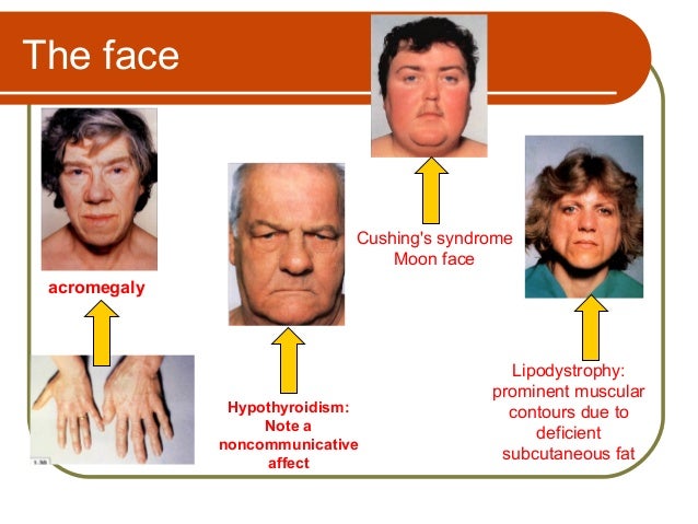 2 огляд хворого