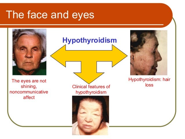 2 огляд хворого