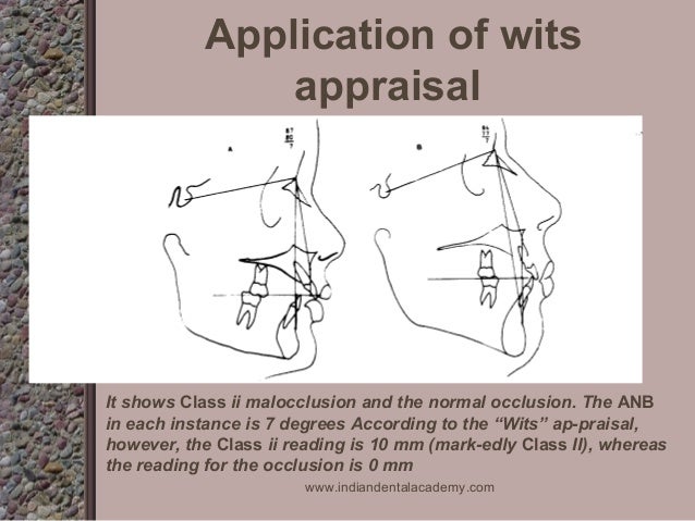 wits appraisal of jaw disharmony.