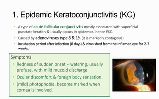 viral conjuctivitis | PPT