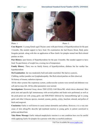 A RARE CASE OF GARLIC INDUCED HYPERSENSITIVITY REACTION | PDF