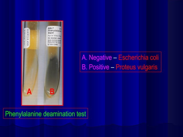 Biochemical tests (2nd part) | PPT