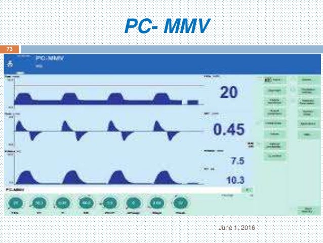 2. ventilatory modes