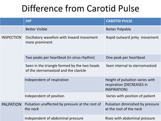 Carotid Vs Jugular Pulse