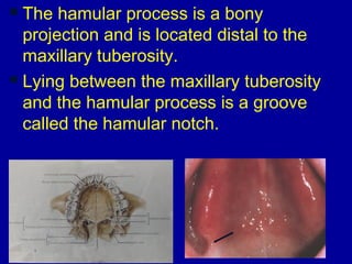 Hamular Process