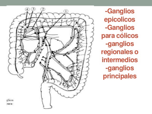 2. cancer de colon