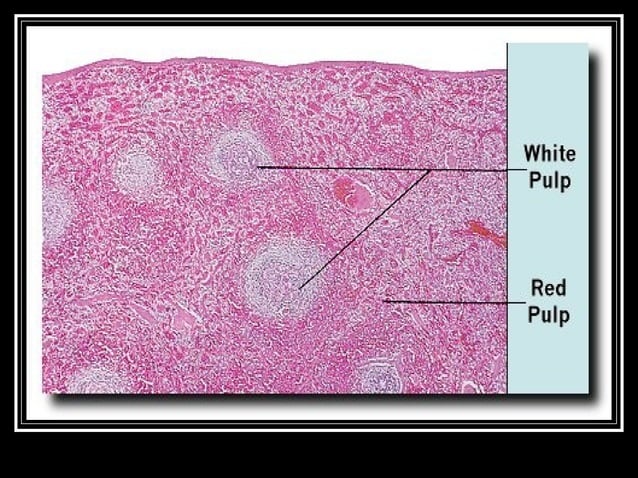 SPLEEN AND RETICULOENDOTHELIAL SYSTEM | PPT | Blood Disorders ...