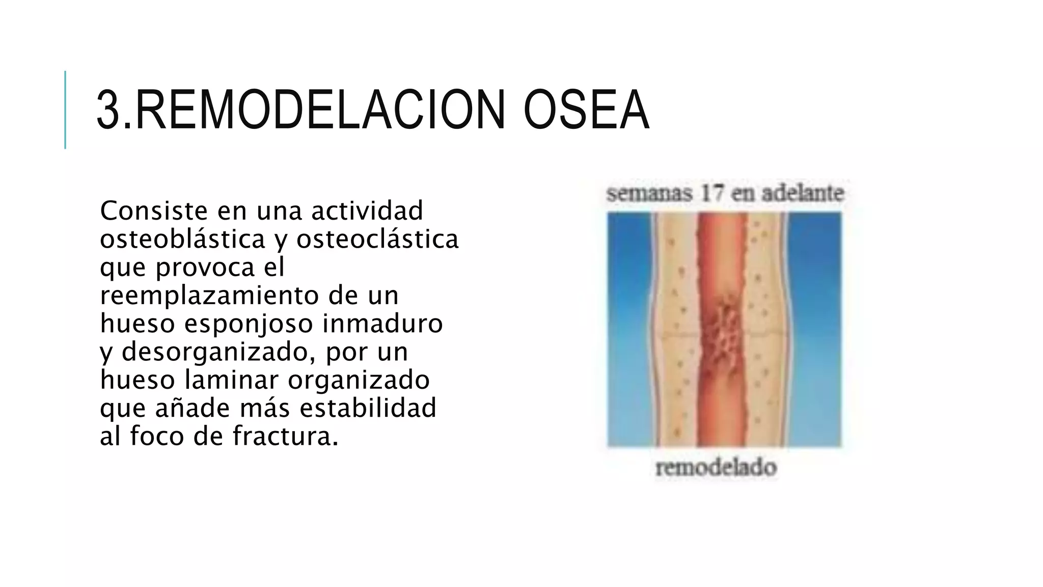 2.1 consolidación ósea | PPTX