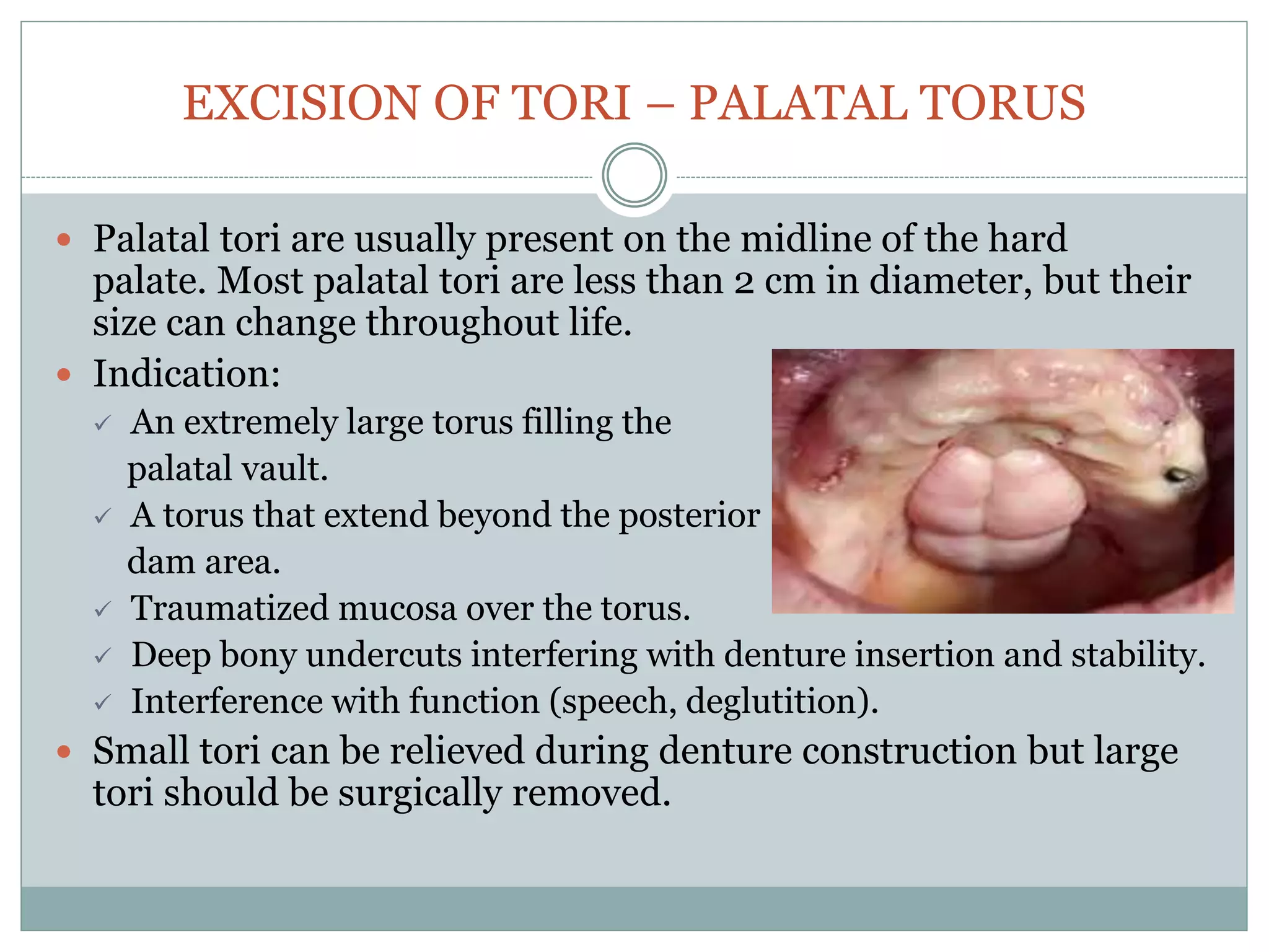 Pre Prosthetic Surgery | PPTX