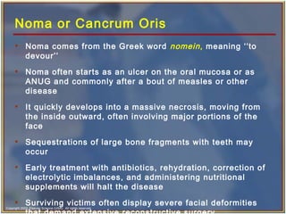 Complex odontogenic infections | PPT