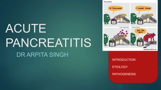 ACUTE PANCREATITIS ,INTRODUCTION, AETIOPATHOLOGY | PPTX