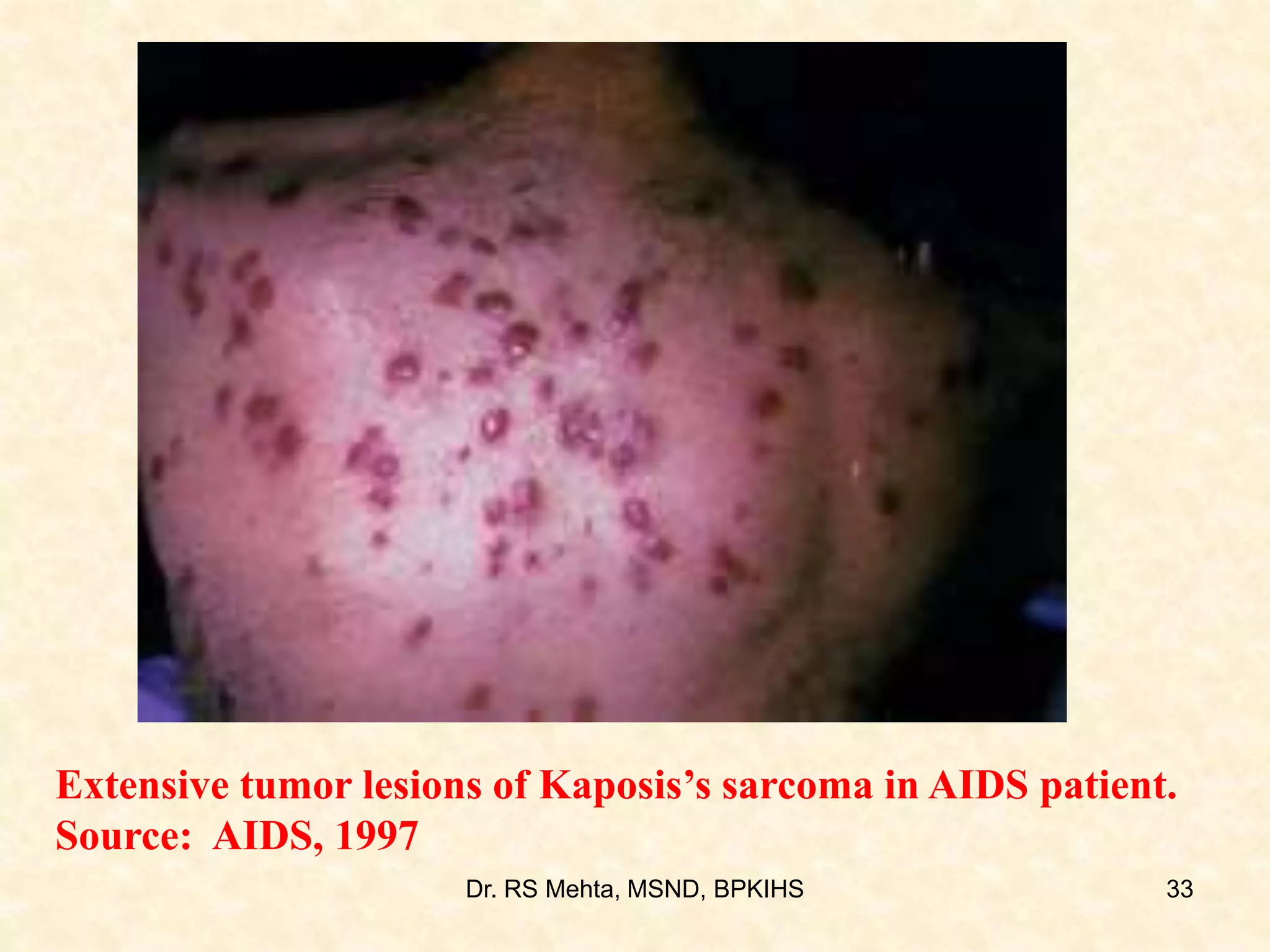 2. hiv aids lecture ppt | PPSX