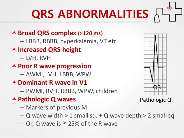 Cardiology 2.1. ECG or EKG - by Dr. Farjad Ikram