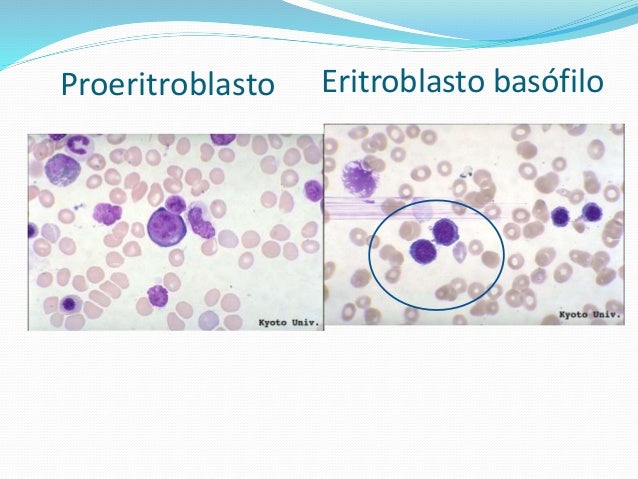 hematopoyesis