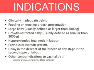 Breech presentation | PPTX