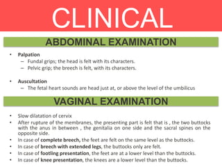 Breech presentation | PPTX