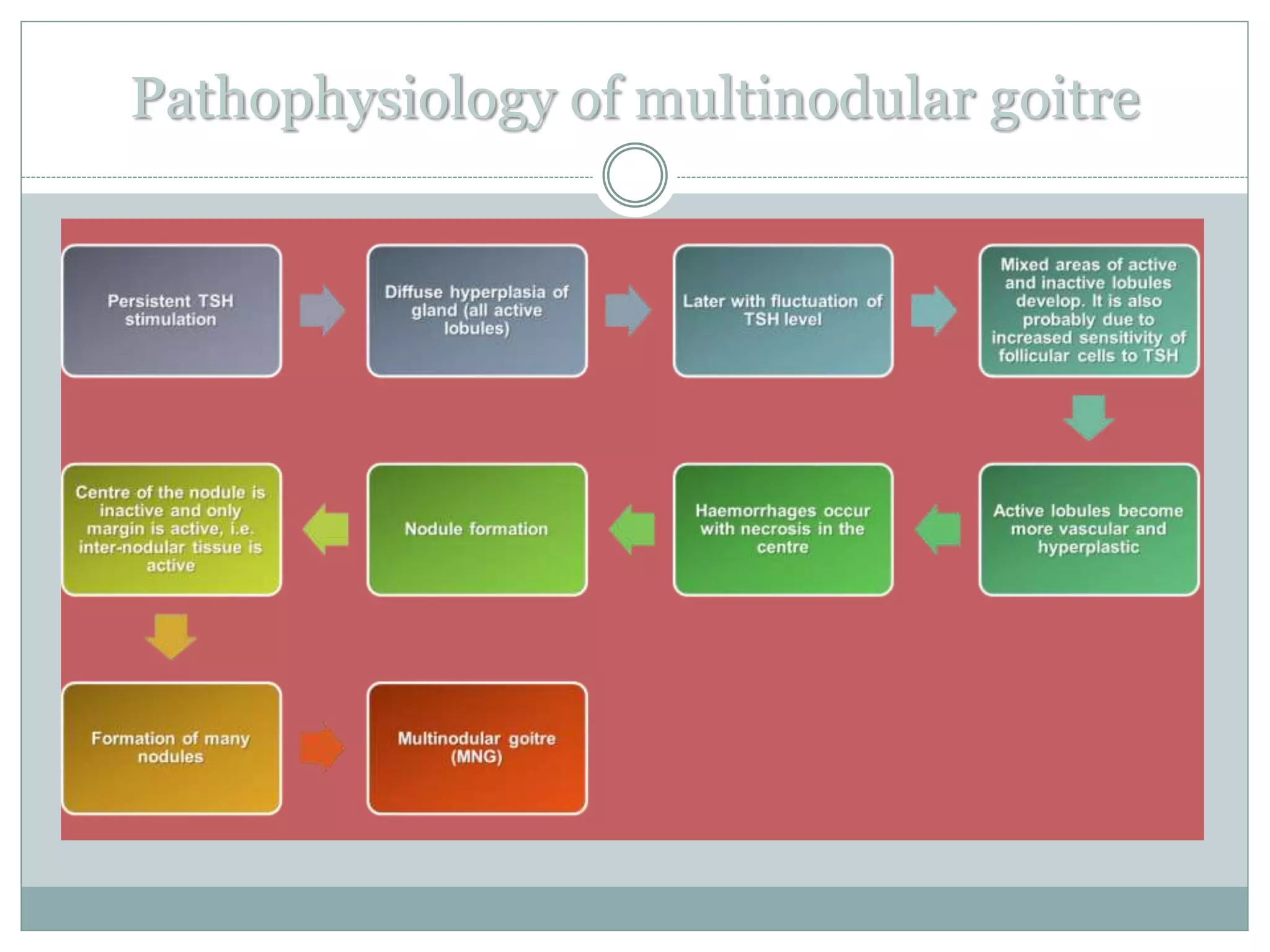 2. classification of goitre | PPTX