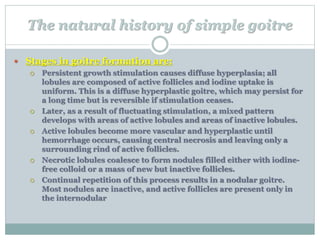 2. classification of goitre | PPTX