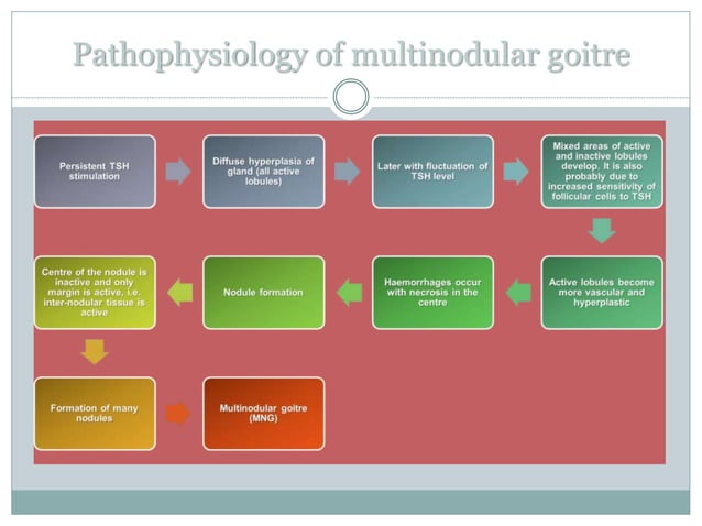 2. classification of goitre | PPTX