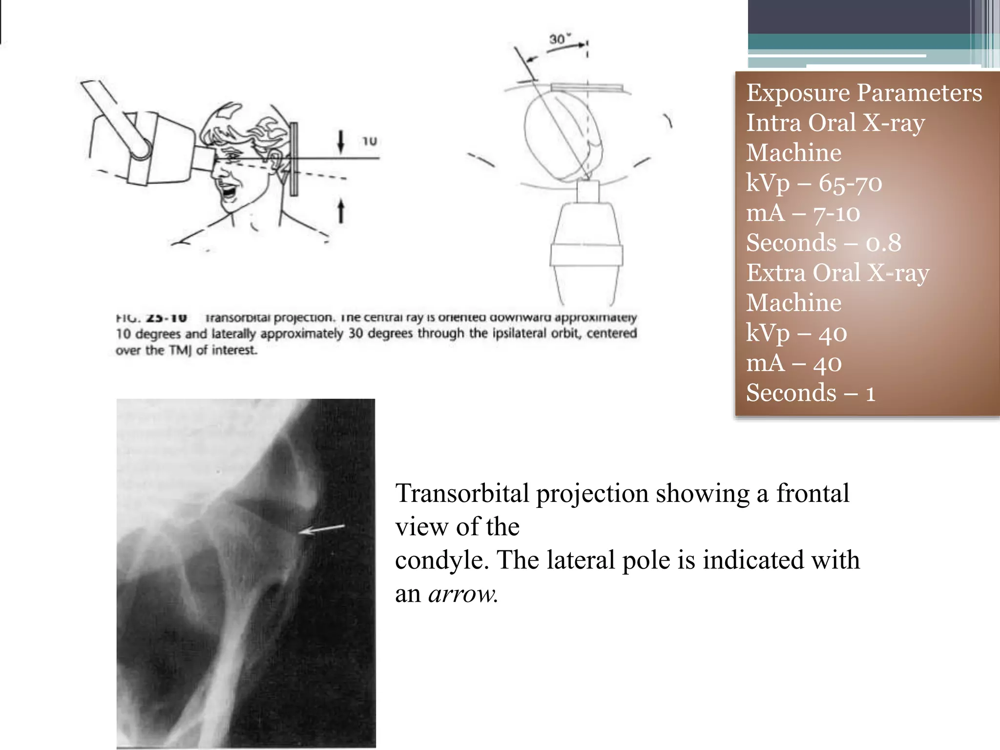 TMJ Radiology & Applied Aspect | PPTX