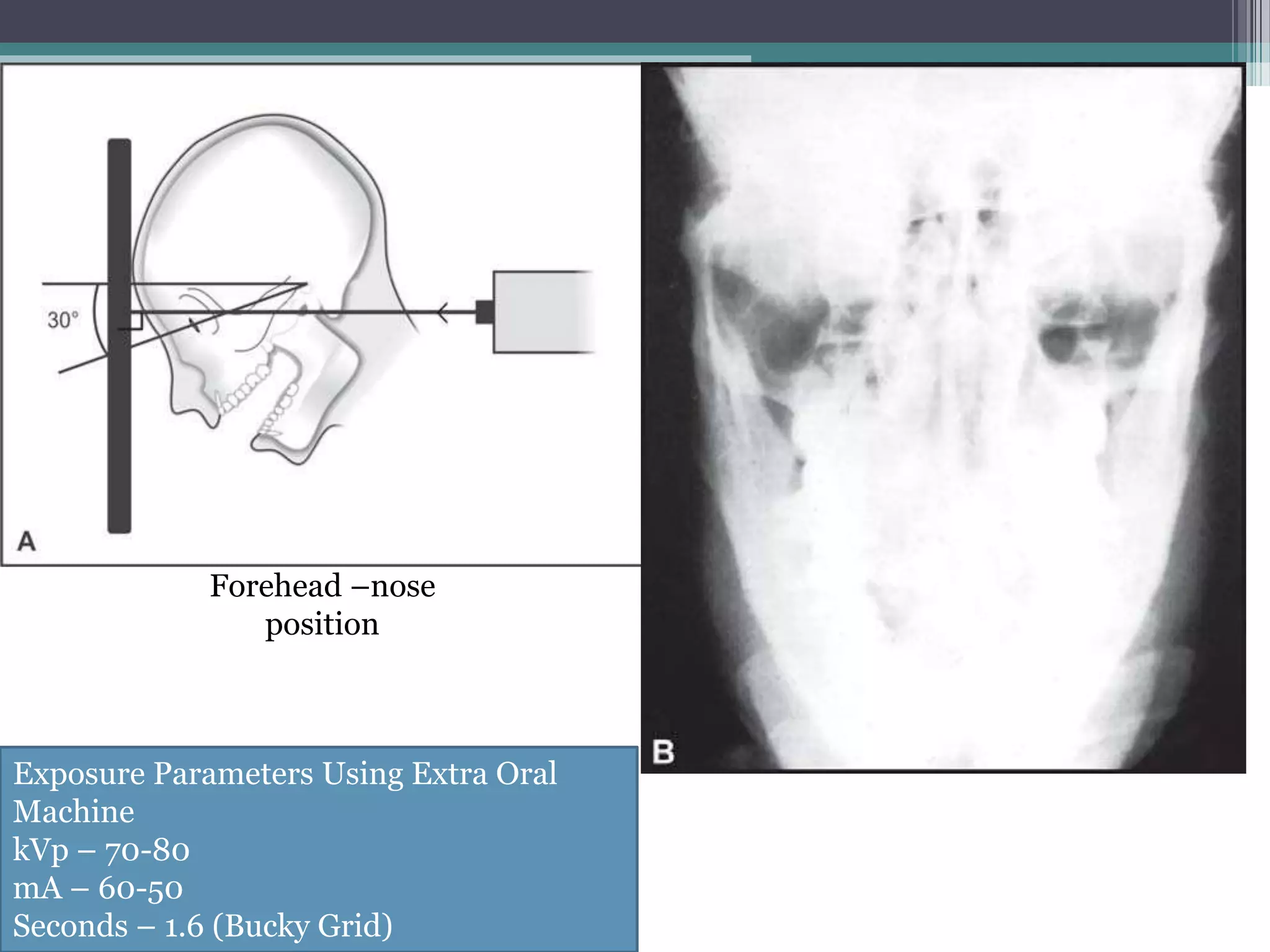 TMJ Radiology & Applied Aspect | PPTX