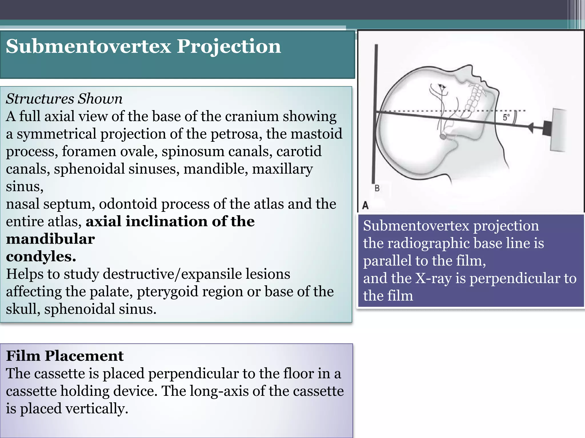 TMJ Radiology & Applied Aspect | PPTX