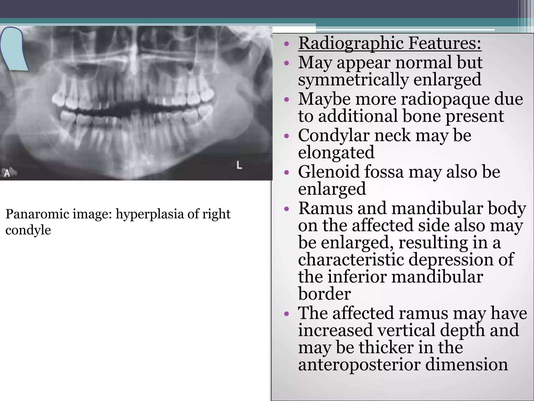 TMJ Radiology & Applied Aspect | PPTX