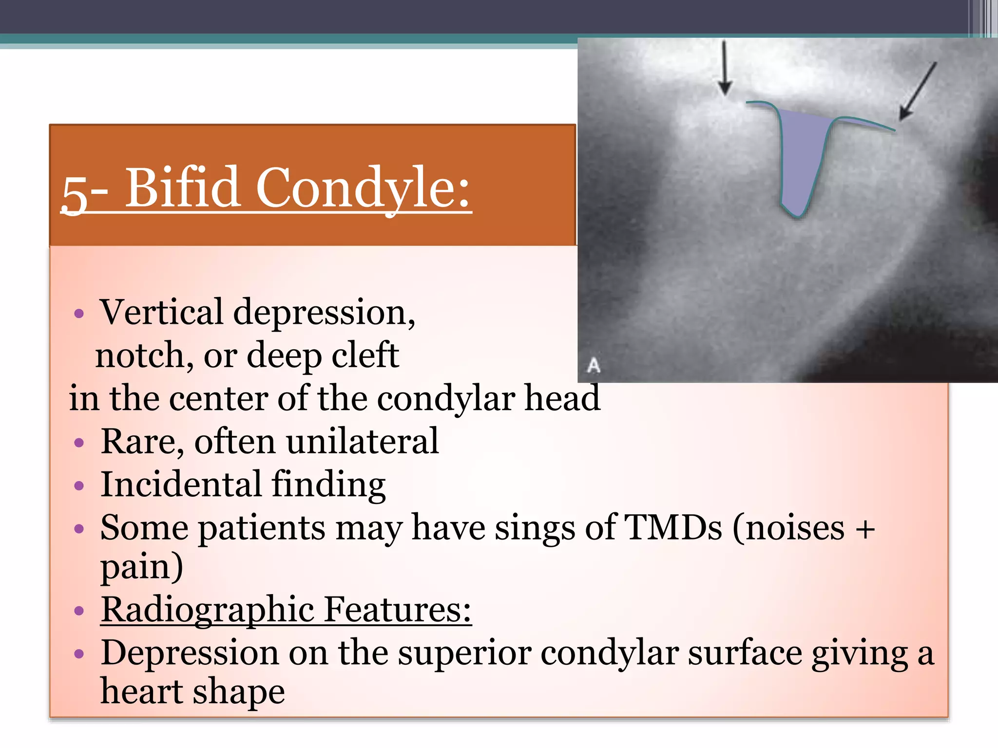 TMJ Radiology & Applied Aspect | PPTX