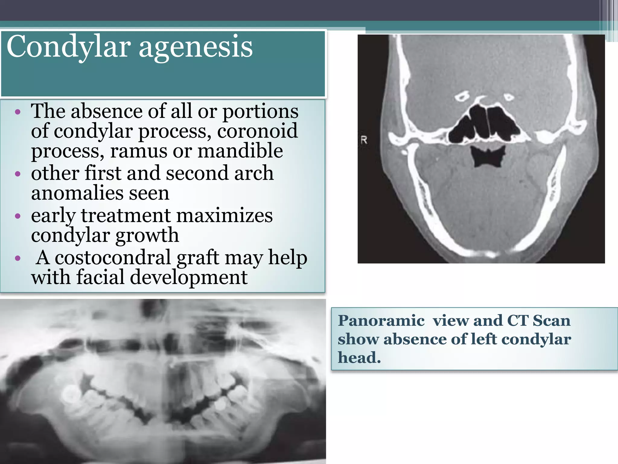 TMJ Radiology & Applied Aspect | PPTX