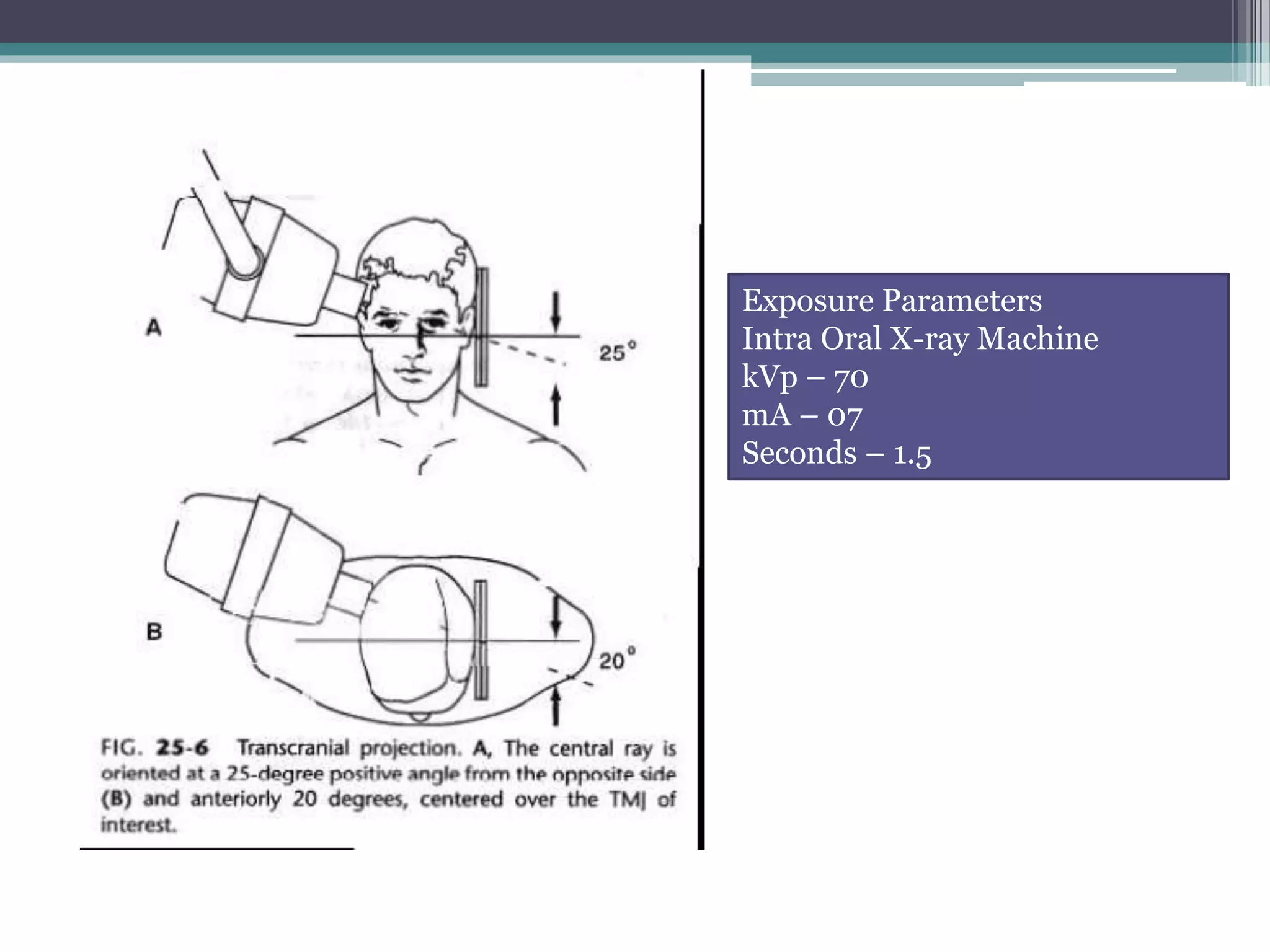 TMJ Radiology & Applied Aspect | PPTX