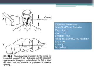 TMJ Radiology & Applied Aspect | PPTX