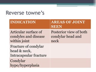 TMJ Radiology & Applied Aspect | PPTX