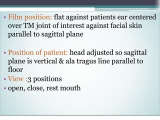 TMJ Radiology & Applied Aspect | PPTX