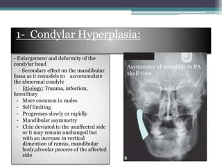 TMJ Radiology & Applied Aspect | PPTX