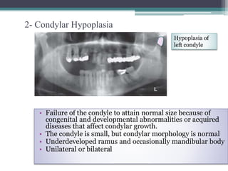 TMJ Radiology & Applied Aspect | PPTX