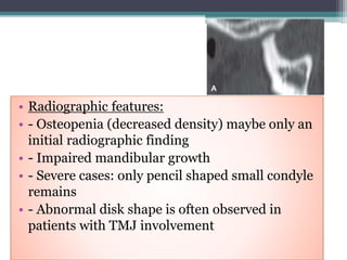 TMJ Radiology & Applied Aspect | PPTX