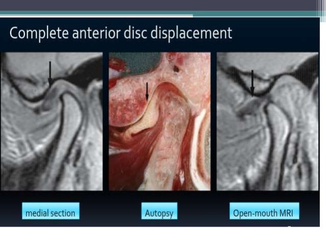 TMJ Radiology & Applied Aspect