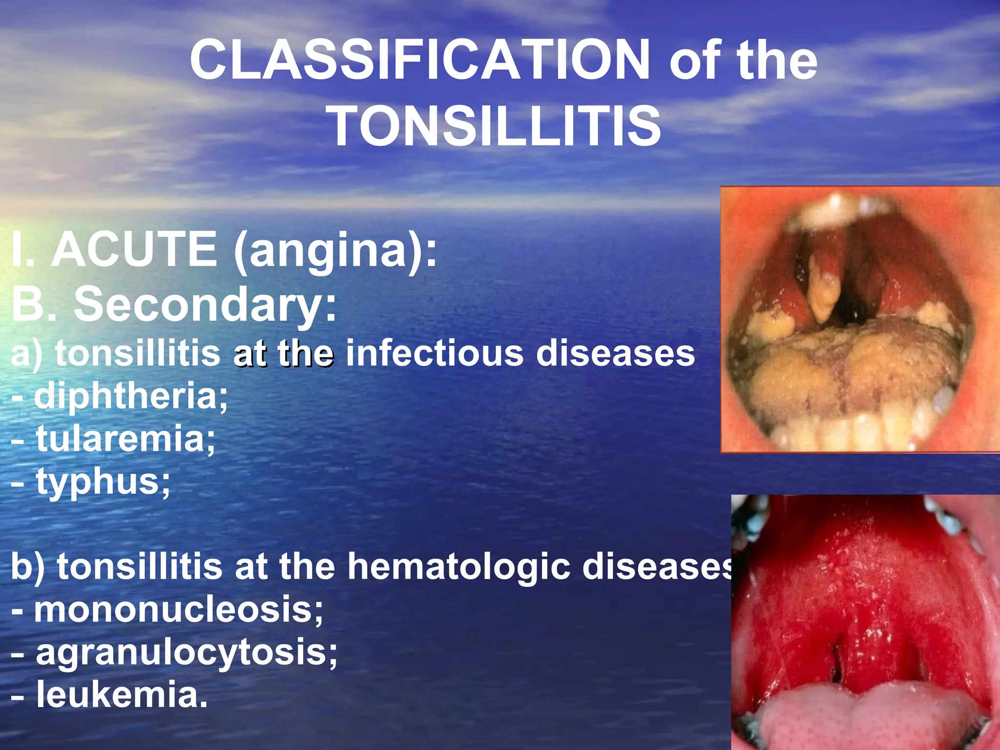 Anatomy & Physiology of pharynx. Tonsillitis | PPT